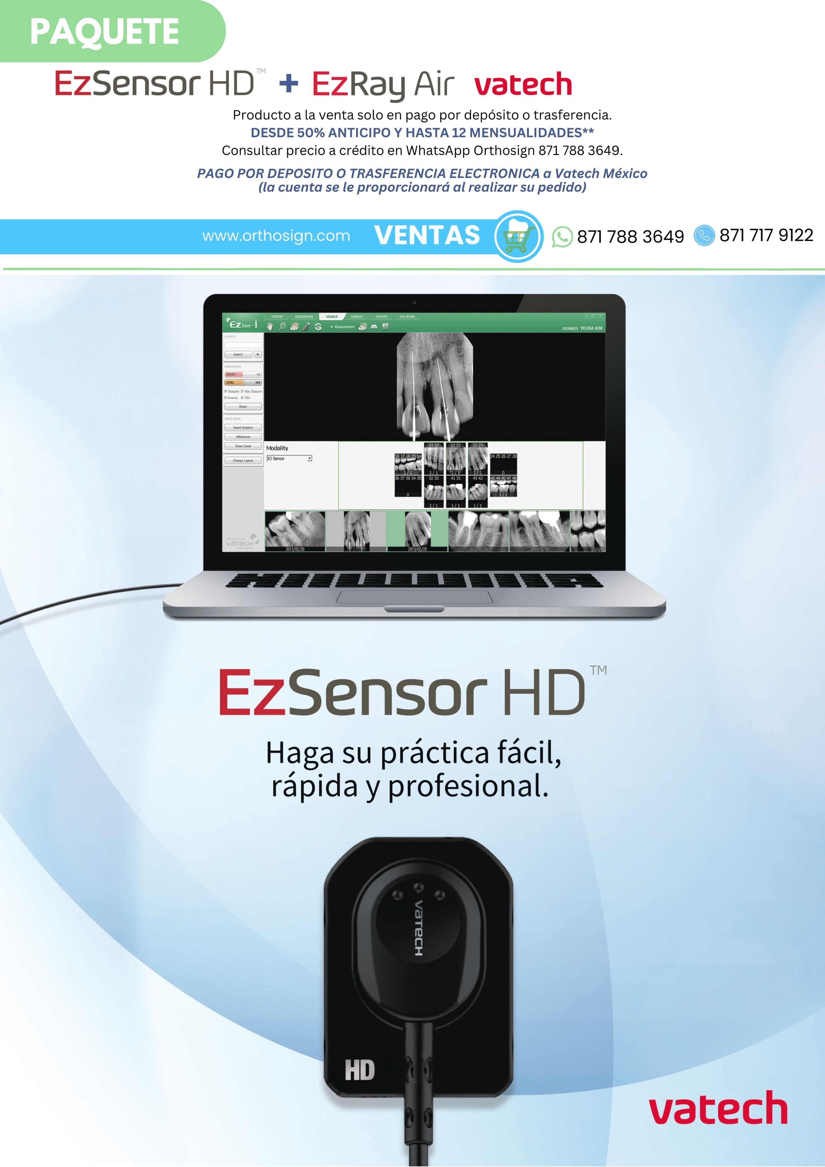Paquete Radiovisiografo Vatech EZ Sensor HD + Rayos X Dental Portátil Ez Ray Air Vatech